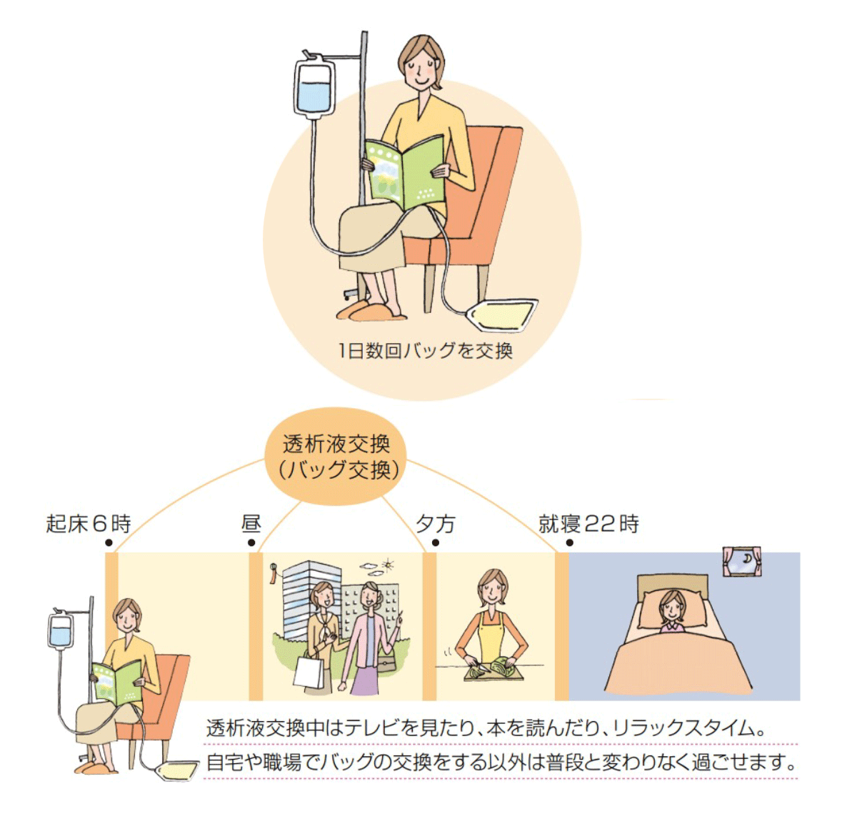 6．PDの方法 | バクスタープロ